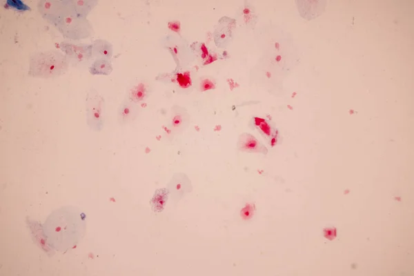 Blastoconidia Stock Photos, Royalty Free Blastoconidia Images ...