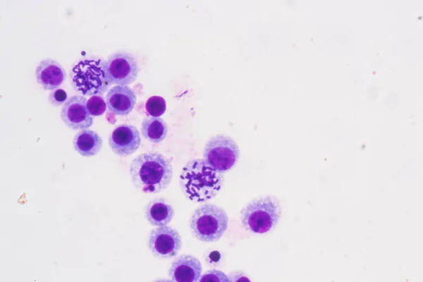 Human leukocyte antigen hla Stock Photos, Royalty Free Human leukocyte ...