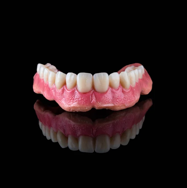 Complete dentures Stock Photos, Royalty Free Complete dentures Images ...