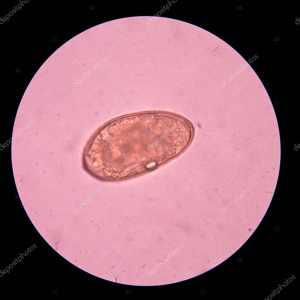 Parasite egg in stool exam. — Stock Photo © toeytoey #103801078