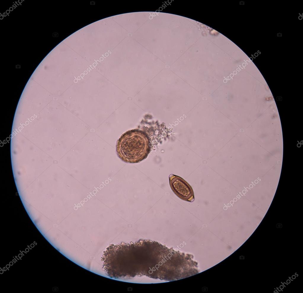 Egg parasite in stool exam. — Stock Photo © toeytoey #103801220