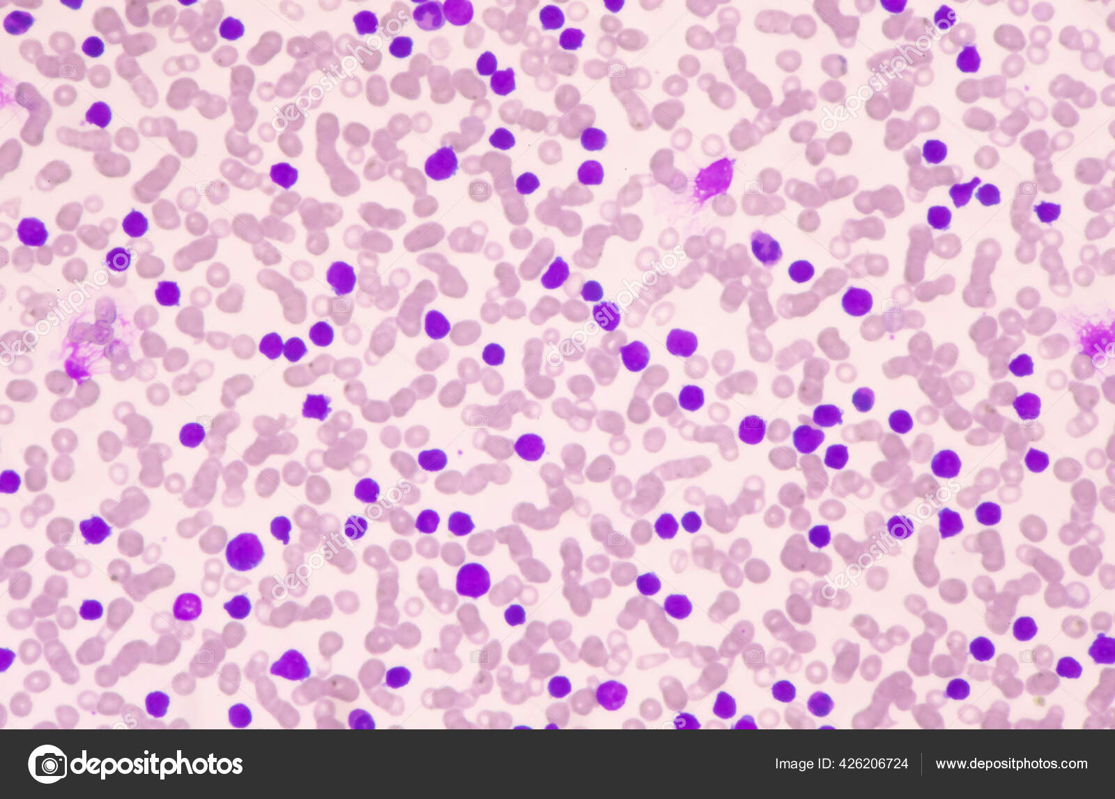 Burst Red Blood Cells Smear