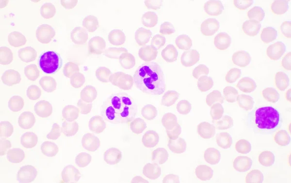 Basket Cell Red Blood Cells Background Medical Science Concept — Stock ...