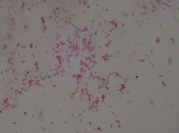 Enterobacter Cloacae Gram Stain