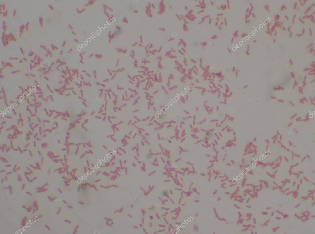 Bacilos gramnegativos con bacterias de tinción bipolares.Burkholderia ...