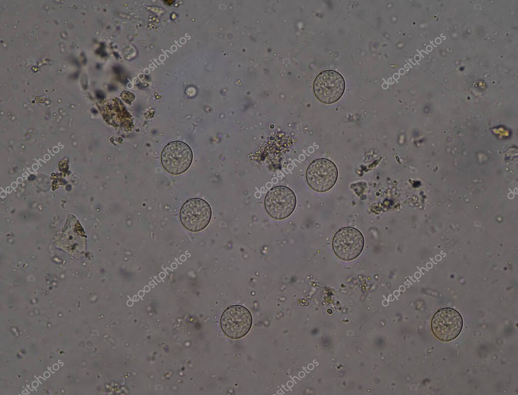 Protozao entamoeba histolytica etapa en el examen de las heces. 2022