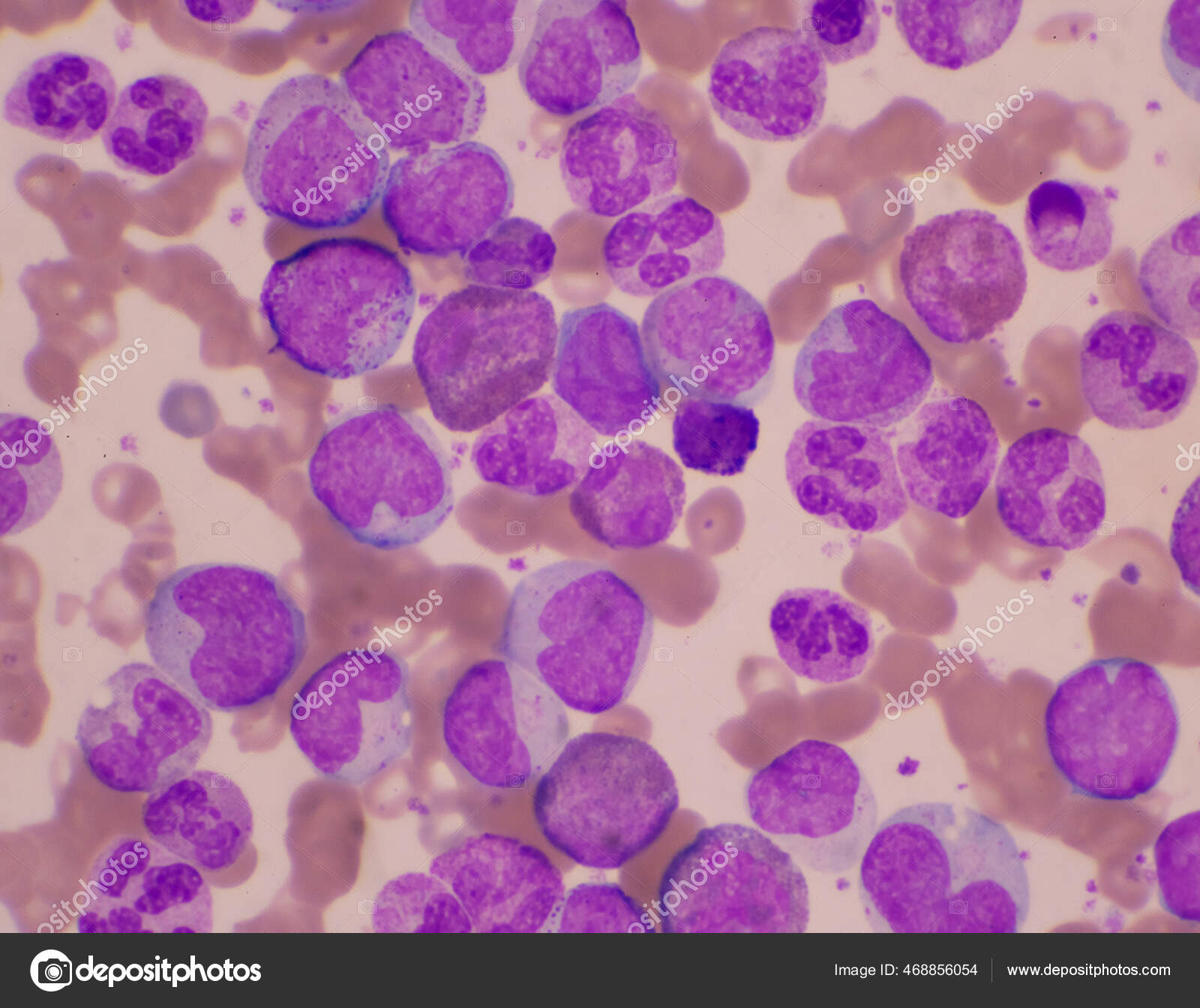 Fundo De Globulos Brancos Glóbulos Vermelhos E Glóbulos Brancos