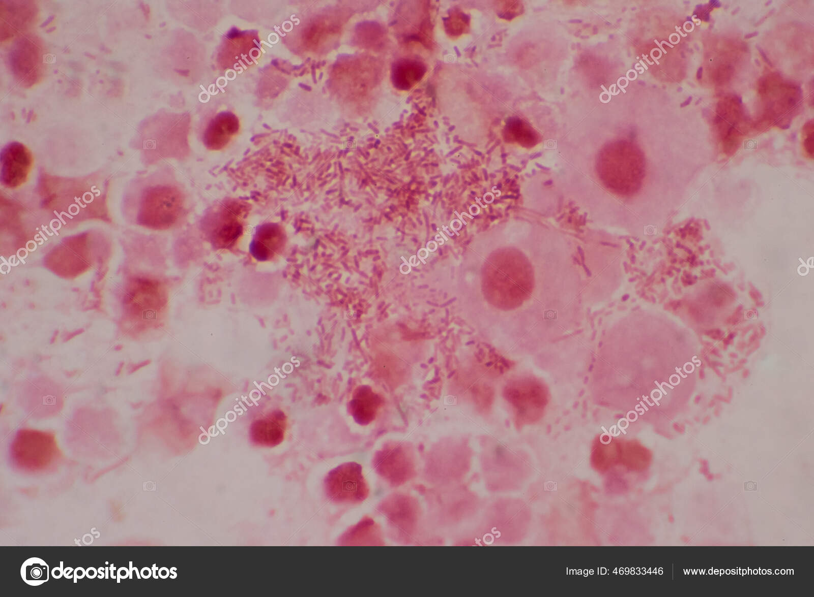 Moderate Gram Nagative Bacilli White Blood Cells Urine Sample — Stock ...