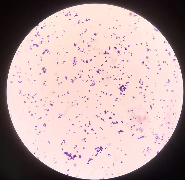 Gram Staining Also Called Gram's Method Method Differentiating ...