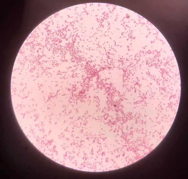 Bacillus cereus Stock Photos, Royalty Free Bacillus cereus Images ...