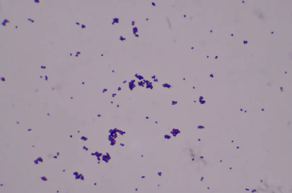 Bifidobacterium microscope Stock Photos, Royalty Free Bifidobacterium ...