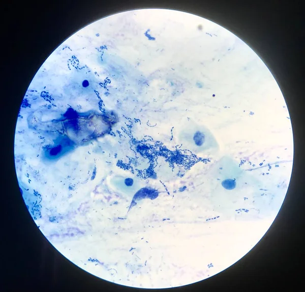 Bacteria gram stain Stock Photos, Royalty Free Bacteria gram stain ...