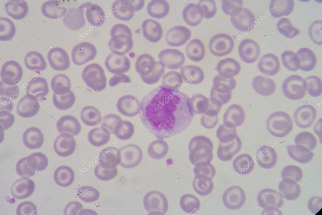 Metamyelocyte