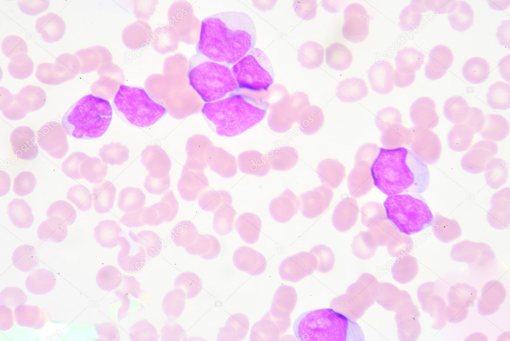 Lymphoblast