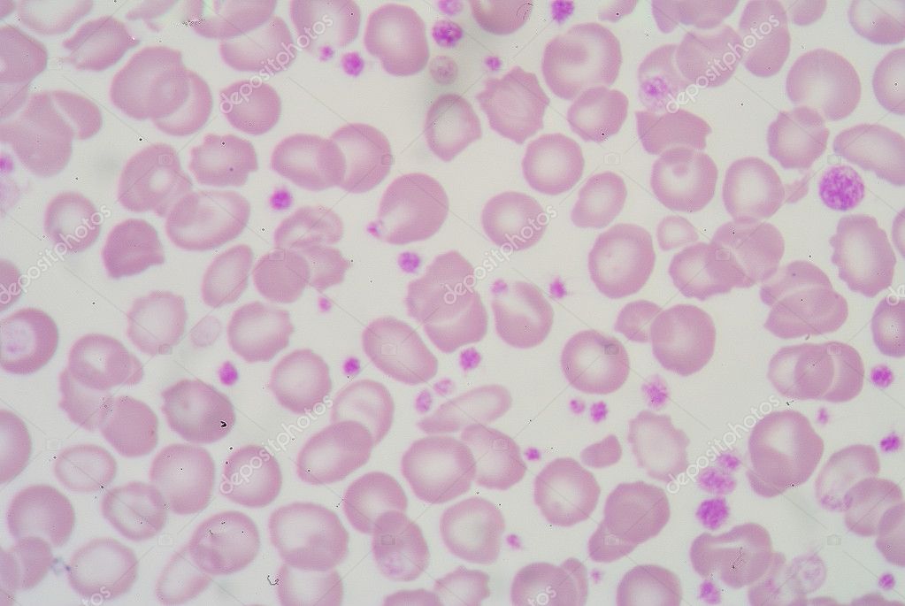 Giant platelet — Stock Photo © toeytoey #63120155