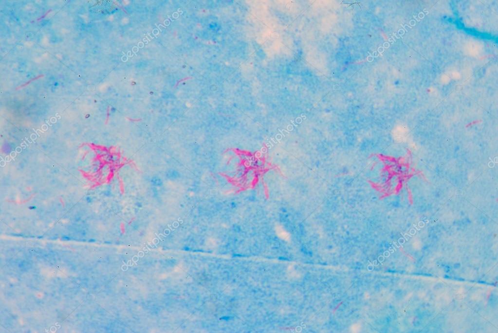 AFB positive — Stock Photo © toeytoey #63120283