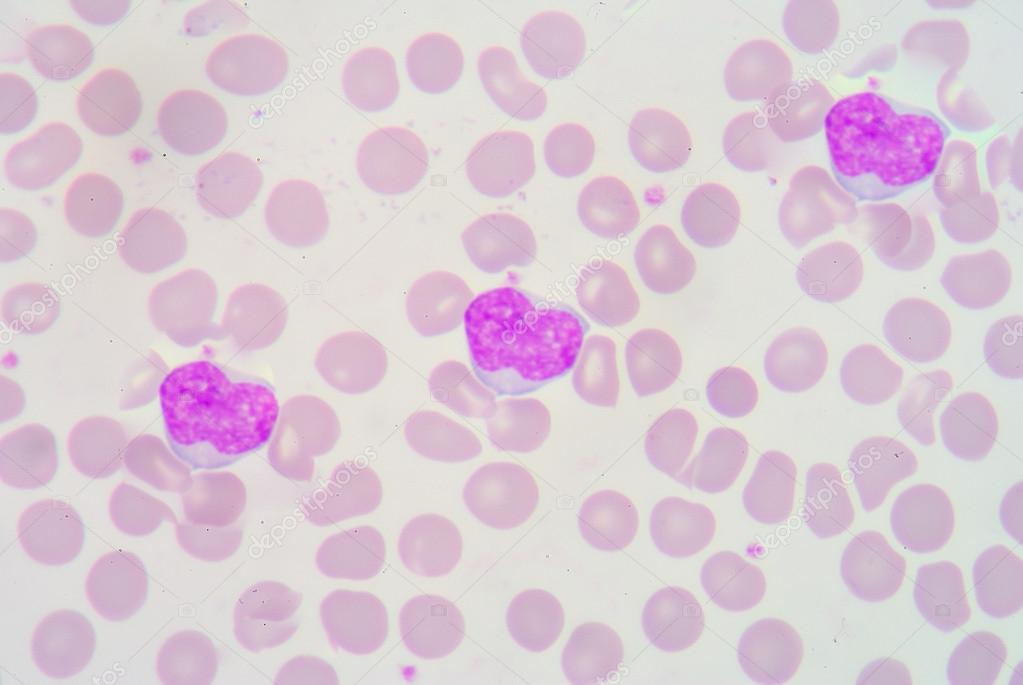 Lymphocyte — Stock Photo © toeytoey #63189189