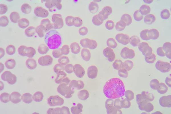 Lymphoblaste — Stock Photo © toeytoey #63120231