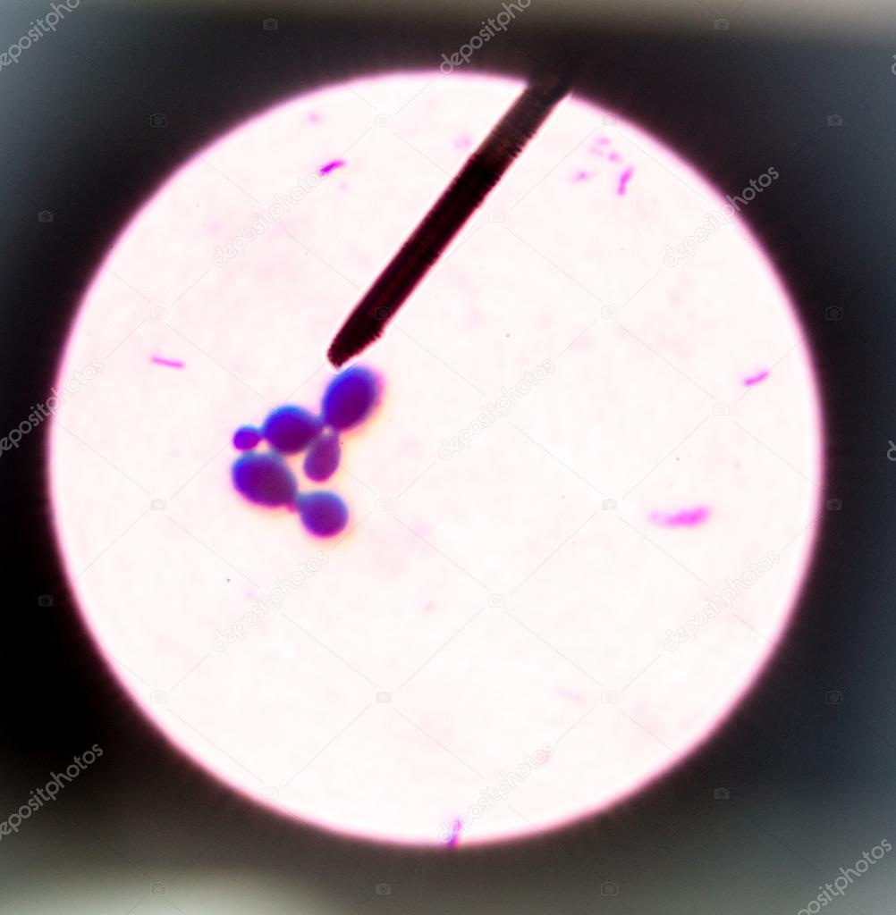 Budding Yeast Cells Under Microscope