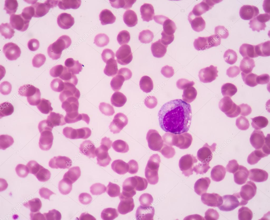 Promyelocyte. Stock Photo by ©toeytoey 78250382