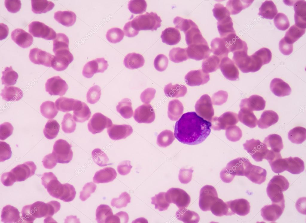 Promyelocyte. — Stock Photo © toeytoey #78250384