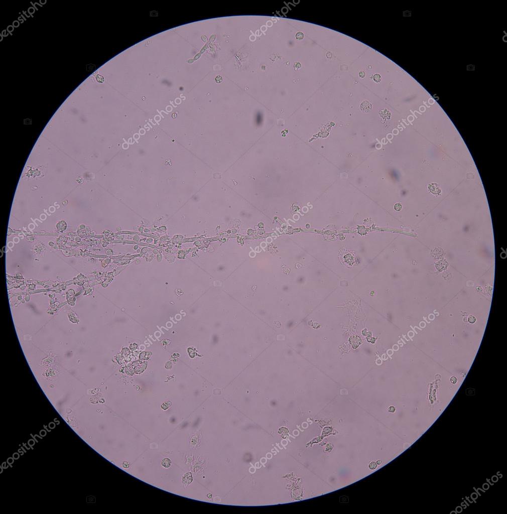 Bacteria In Urine Under Microscope