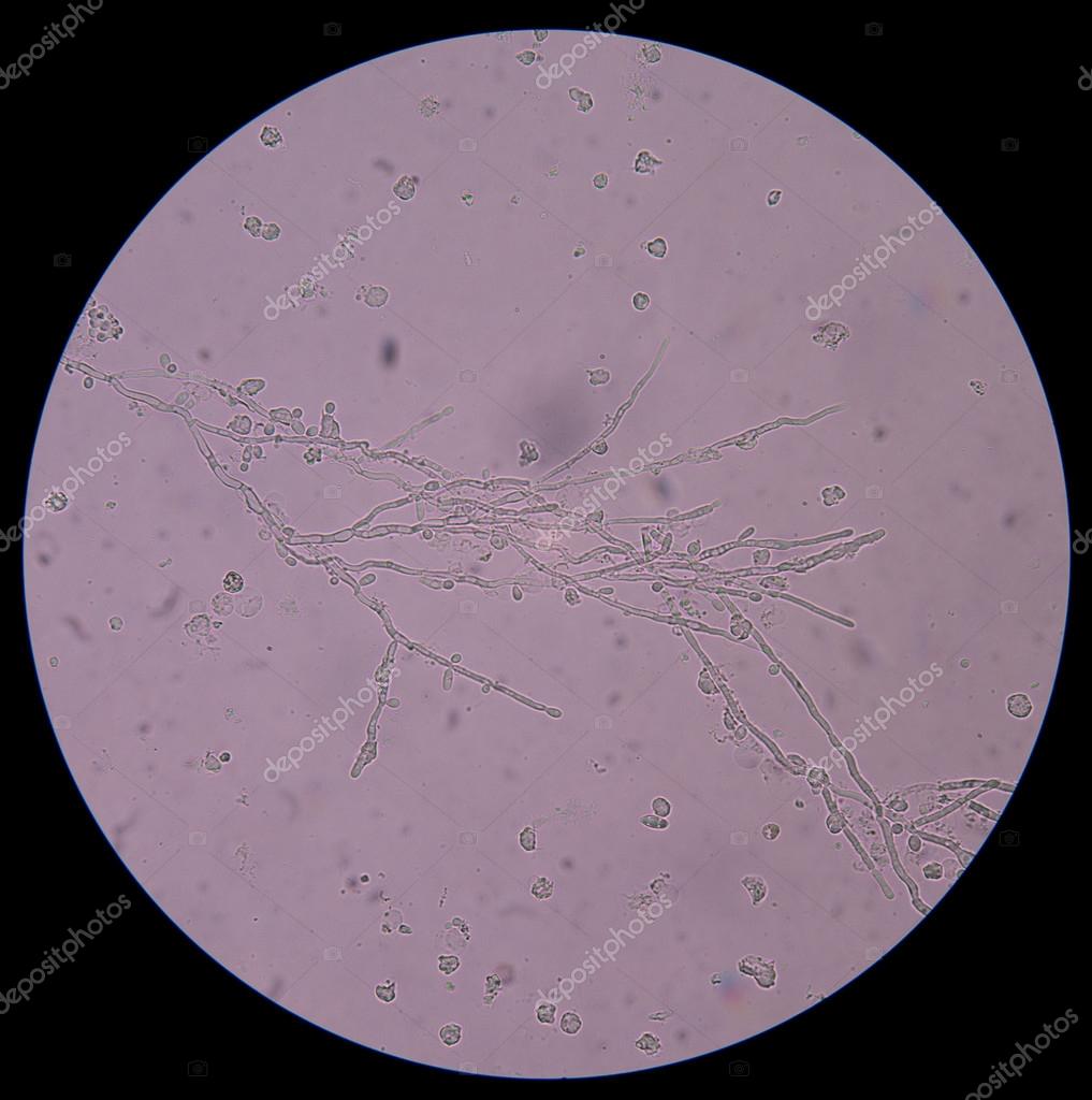 Branching budding yeast cells with pseudohyphae in urine Stock Photo by ...