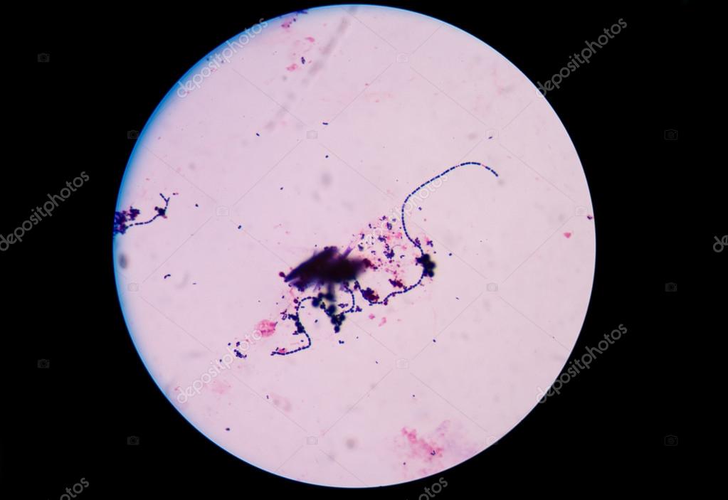 Staphylococcus Gram Stain 100x