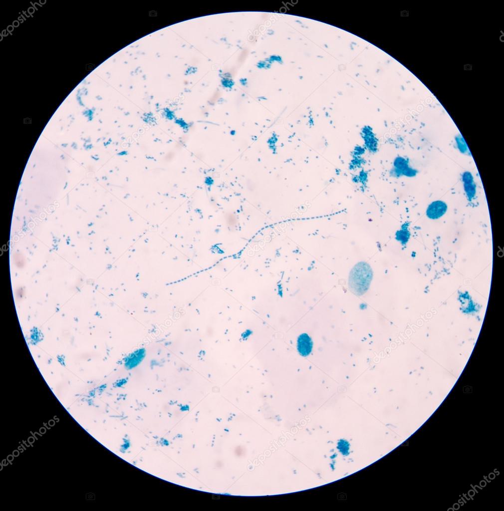 Gram positive cocci in chain. — Stock Photo © toeytoey #97016878