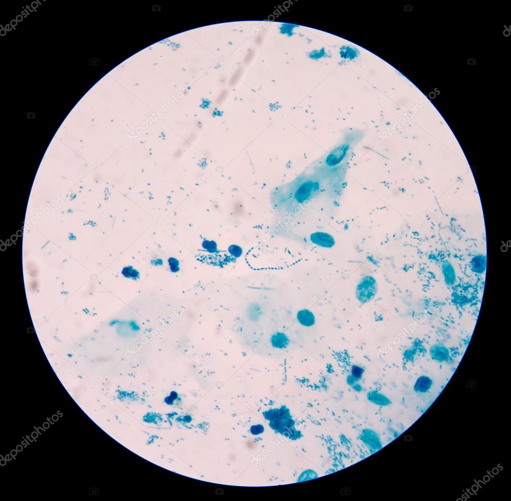 Gram positive cocci in chain. — Stock Photo © toeytoey #97016906