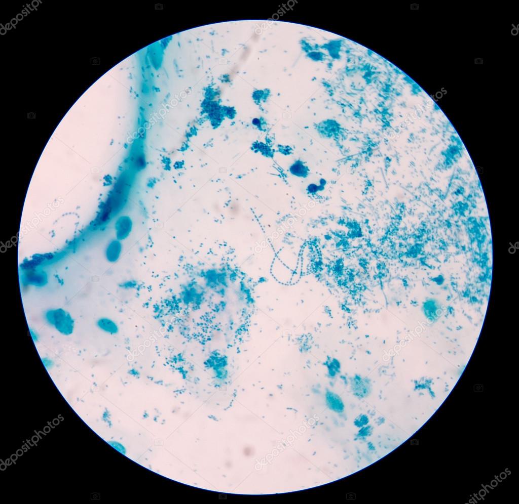Gram staining, also called Gram's method, is a method of differe ...