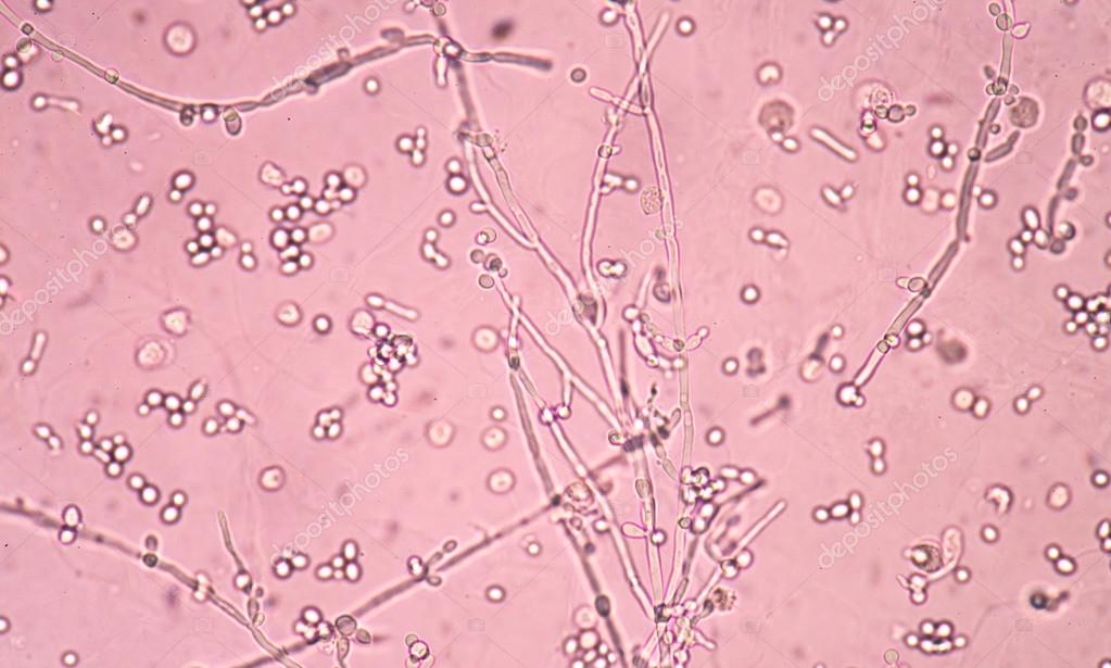 Branching budding yeast cells with pseudohyphae in urine fine w Stock ... Branching budding yeast cells with pseudohyphae in urine fine w Stock ...