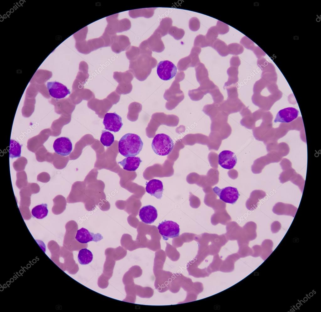 Smaller red to pink normal red blood cells or erythrocytes. Stock Photo ...