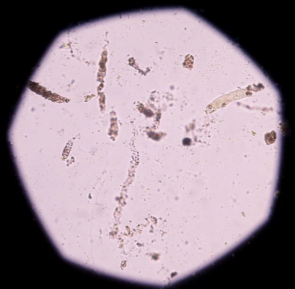 Braeunlich Stock Photos, Royalty Free Braeunlich Images | Depositphotos®