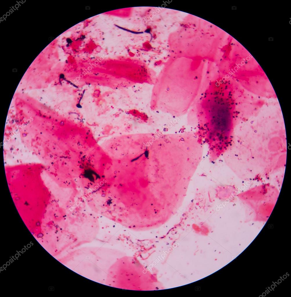 Bacterium blue bacterium gram staining red background Stock Photo by ...