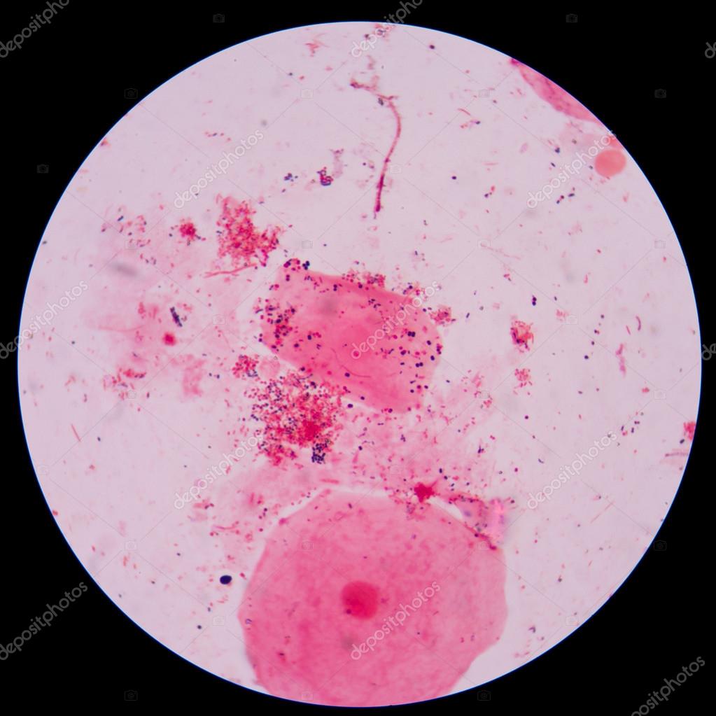 Budding Yeast Gram Stain