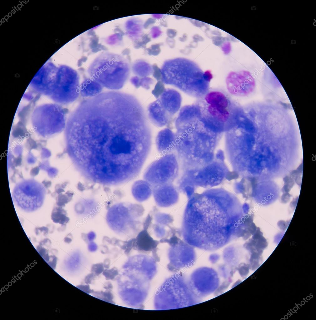 Células mesoteliais no fluido corporal . — Foto © toeytoey #99261398