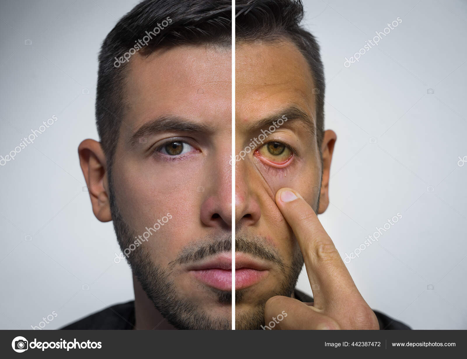 Good And Facial Bad Experssoions