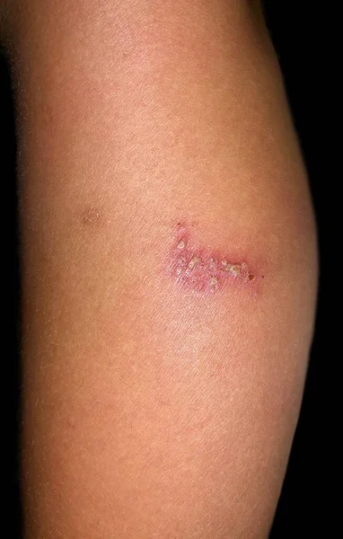 Cuts and bruises Stock Photos, Royalty Free Cuts and bruises Images ...