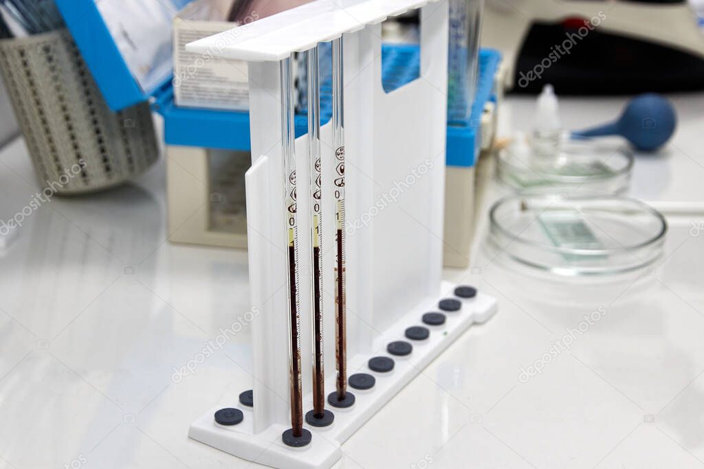Pipetas capilares serológicas con muestras de sangre para análisis 2024