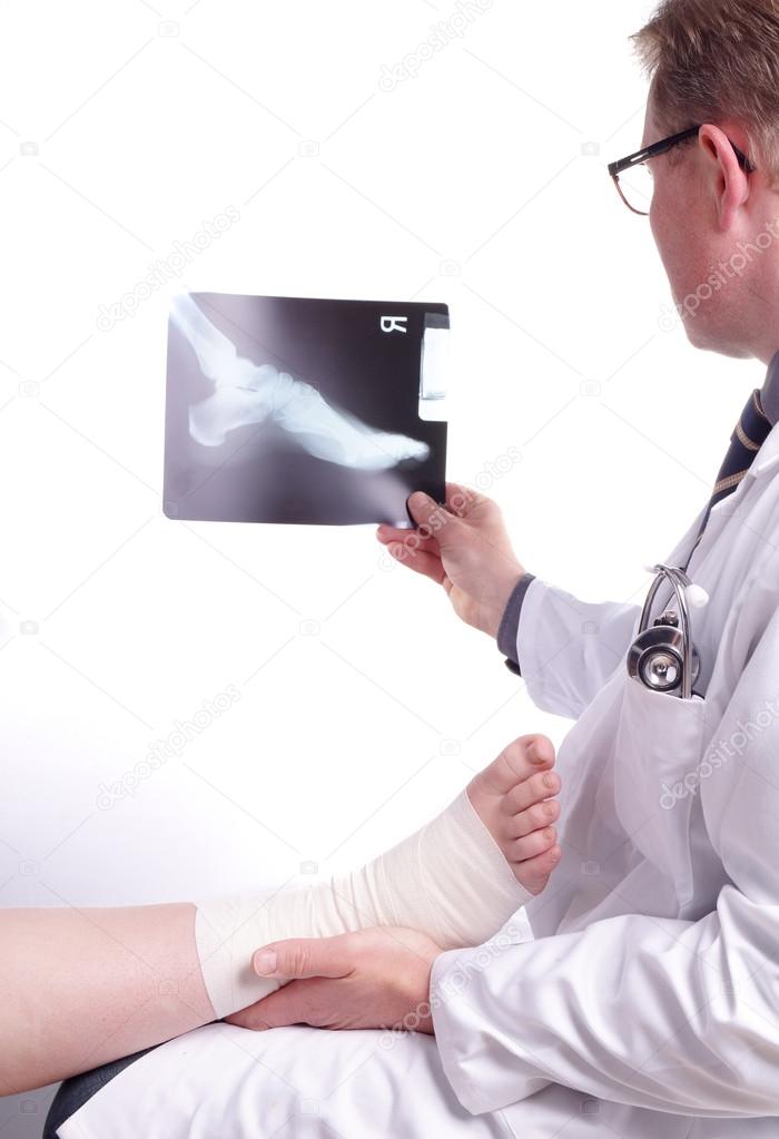 Doctor exam one X-ray picture of sprained foot — Stock Photo ...