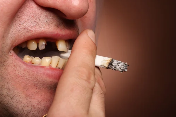 Bad teeth smoker Stock Photo by ©v.gi 63679827