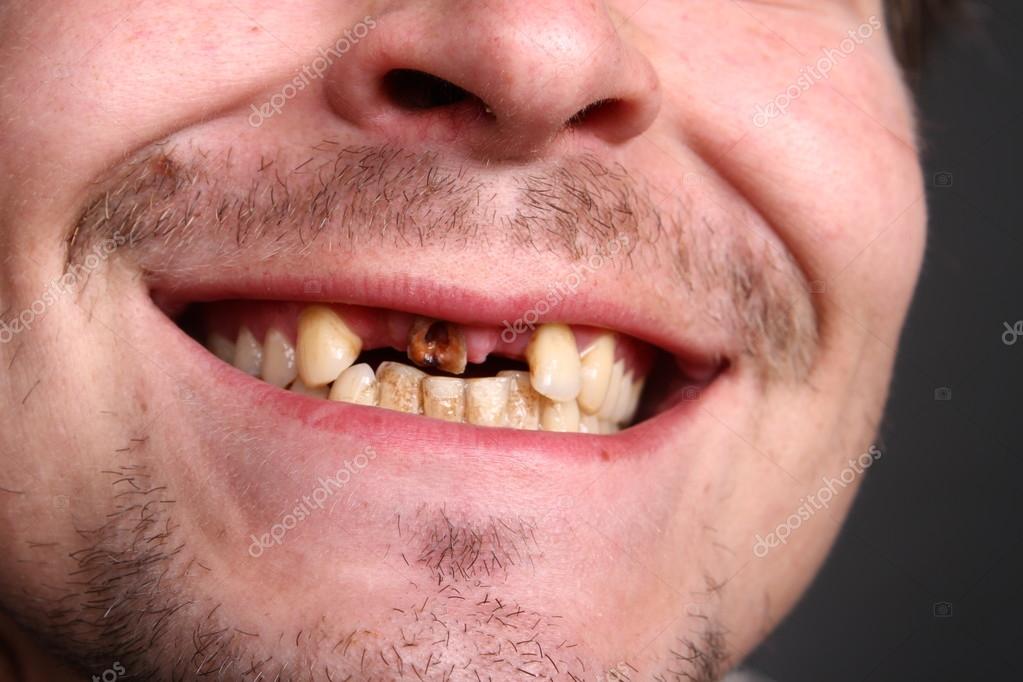 Bad teeth — Stock Photo © v.gi #73356915