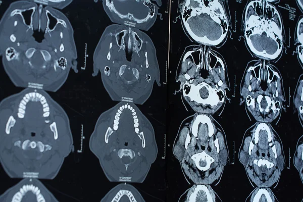 Unusual view of the MRI, X-ray images of the patient — Stock Photo ...