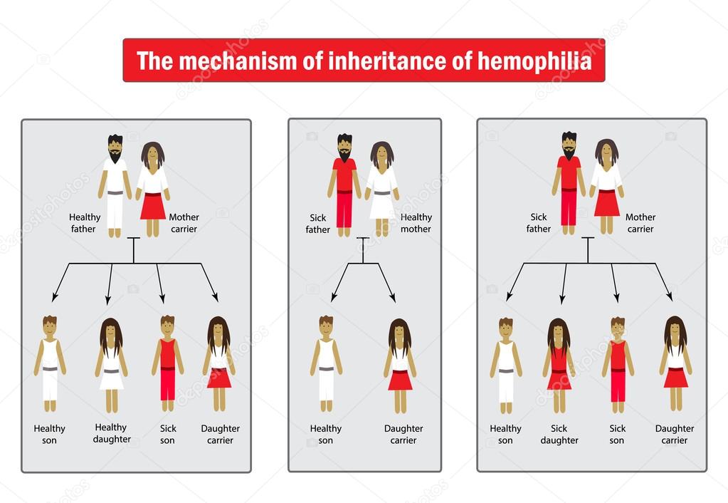 The mechanism of inheritance of hemophilia. Infographics. Vector illustration on isolated ...