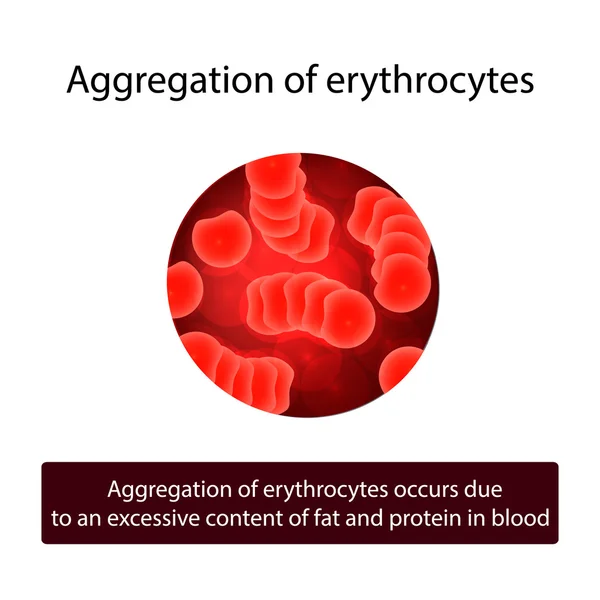 The structure of microglia. Neuron. Nerve cell. Infographics. Vector ...