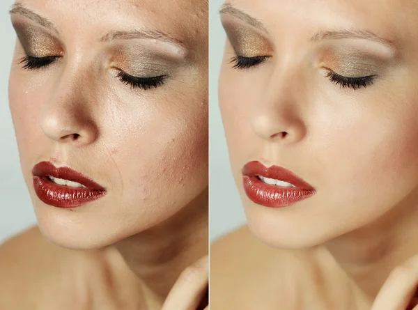 Blemishes Stock Photos, Royalty Free Blemishes Images | Depositphotos