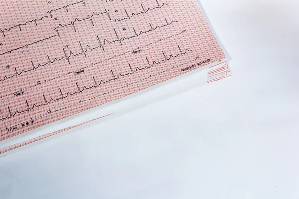 Cardiac paper Stock Photos, Royalty Free Cardiac paper Images ...