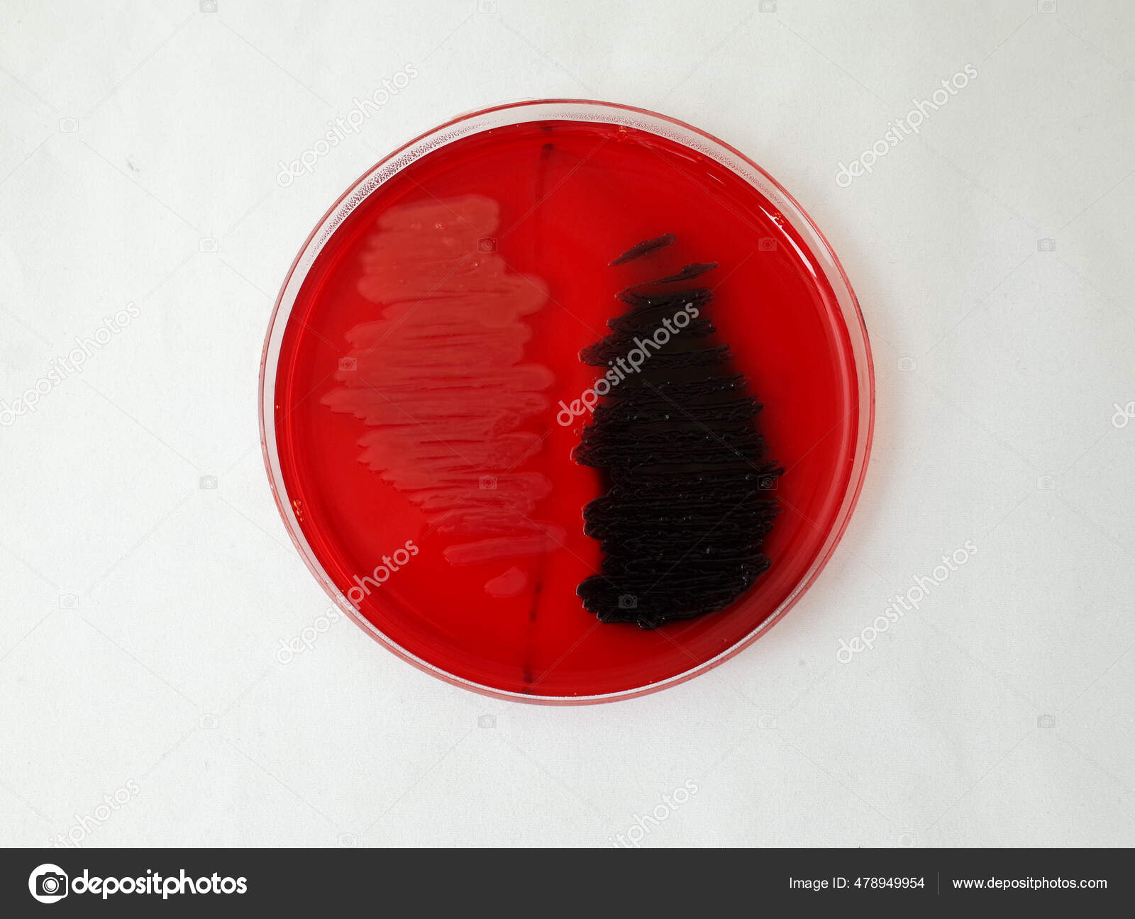 Bacterial Gowth Congo Red Agar Plate Test Ability Bacteria Broduce ...