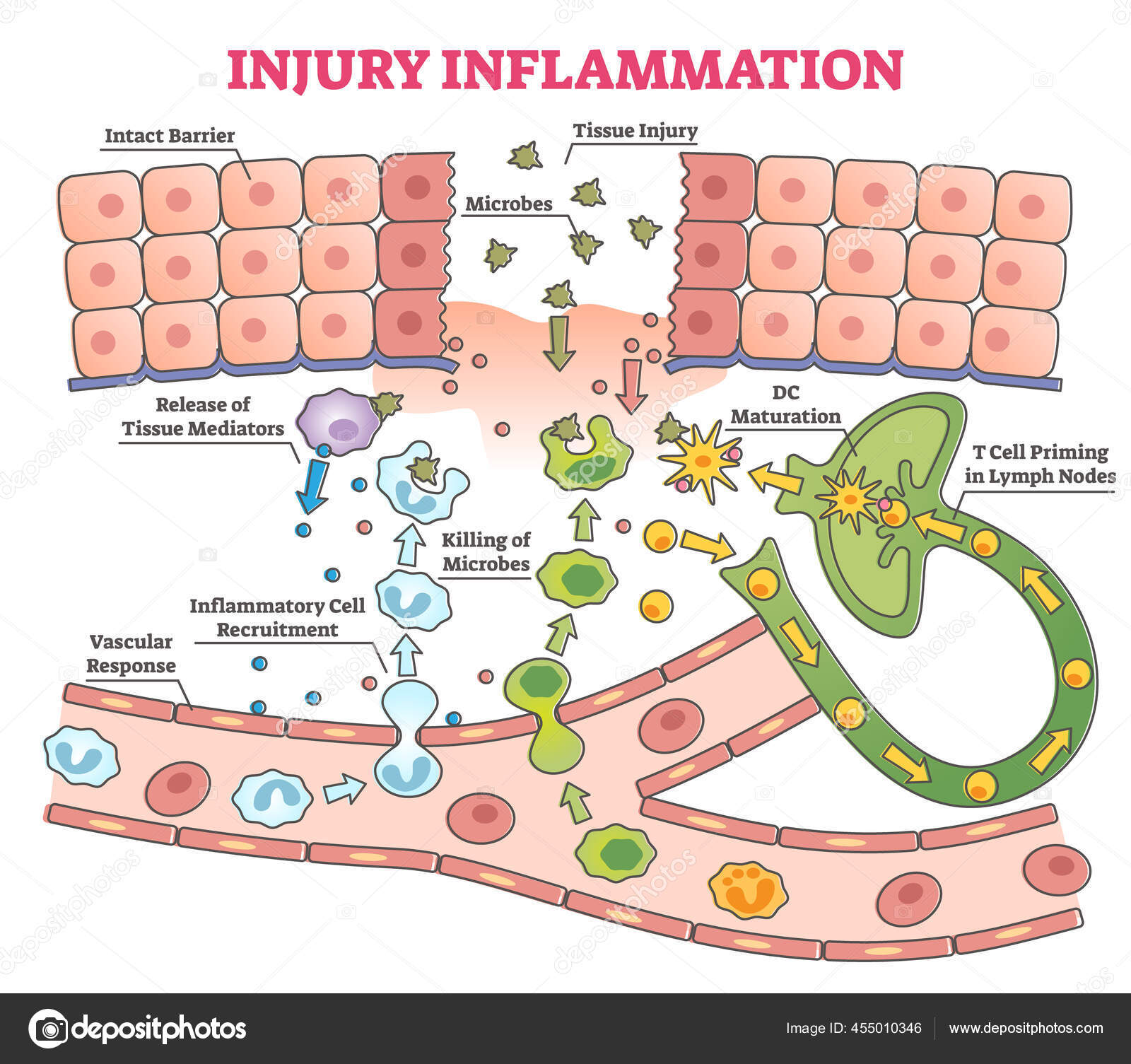 Inflamación de las lesiones como proceso de respuesta corporal en el ...
